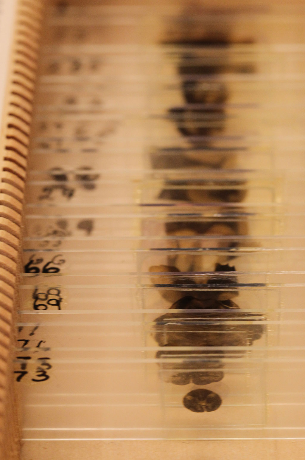 Mutter Museum Einstein Brain